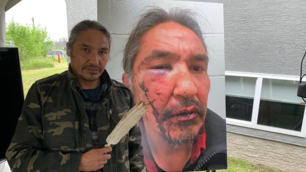 First Nations chief calls for police-worn body cameras a year after ...