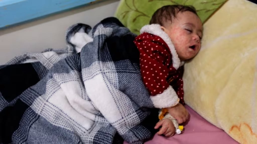 Everything you need to know about protecting yourself against measles ...