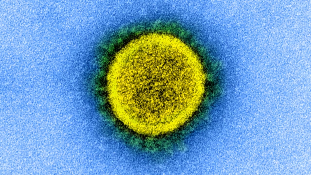 Highly-mutated COVID virus variant BA.2.86 sumulpot sa maraming bansa ...