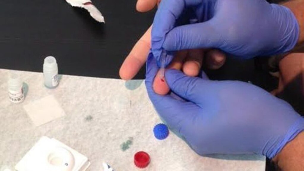 A Toronto man could become the 1st Canadian cured of HIV thanks to rare ...