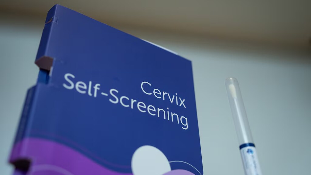 Ontario lumipat sa HPV test para sa screening ng cervical cancer ...