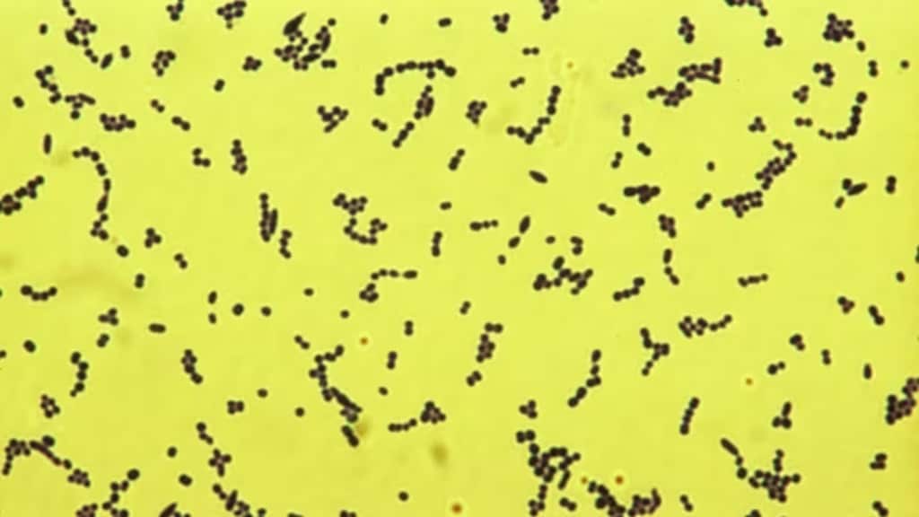 Spike in severe illness caused by strep A bacteria is ’global ...