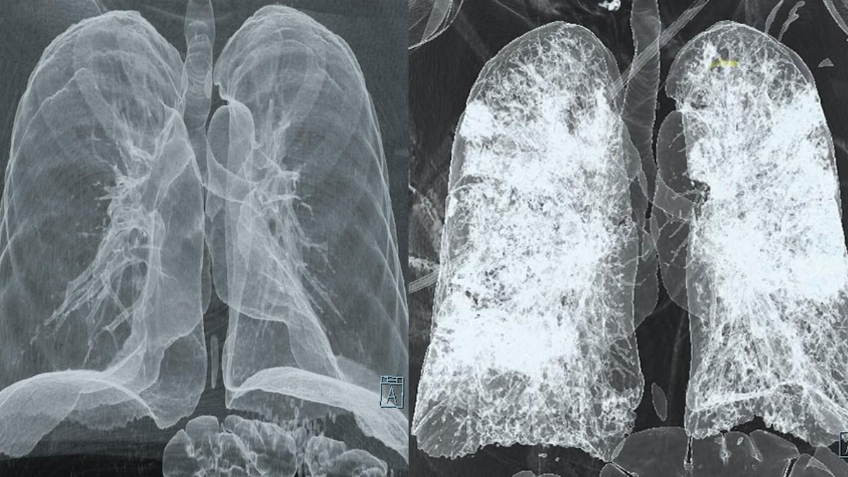 En continu | Science | Radio-Canada | Page 190