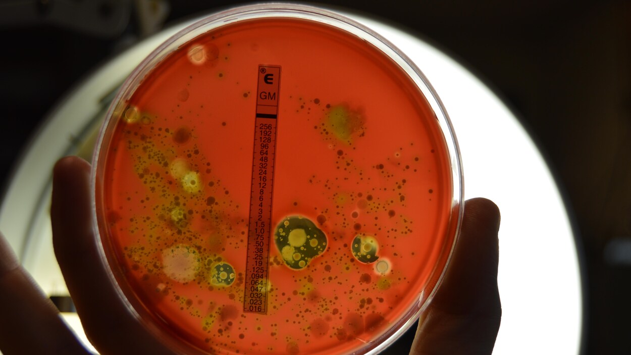 Les superbactéries prospèrent aussi à cause de la pollution, met en ...