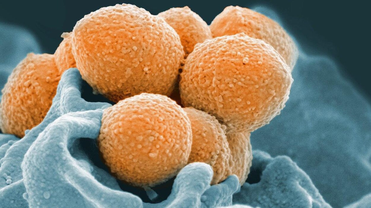 Hausse des cas d’infections à streptocoque dans la région | Radio-Canada