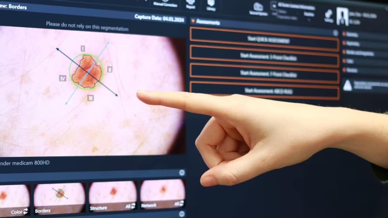 L’intelligence artificielle utile dans le dépistage du cancer de la ...
