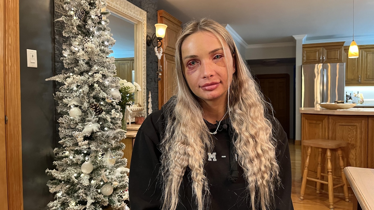 Sauvagement battue, une jeune femme espère « aider les autres à s’en ...