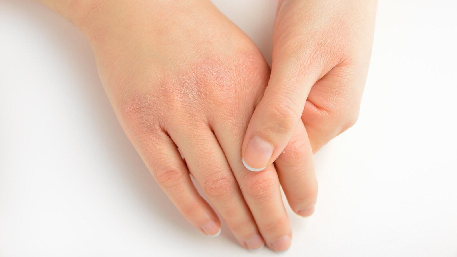 Qu'est-ce qui craque dans nos jointures? | ICI Radio-Canada.ca