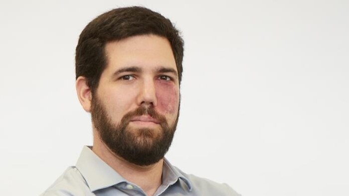 Y a-t-il trop de magasins de cannabis illégaux à Toronto? | Radio-Canada.ca