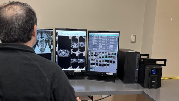 Une nouvelle technologie pour mieux détecter le cancer de la prostate ...