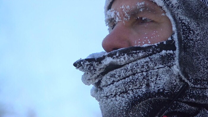 Winnipeg a enregistré le plus grand nombre de cas de gelures et d ...