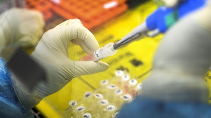 Dépister la COVID-19 en 15 minutes grâce aux tests sérologiques | Radio ...