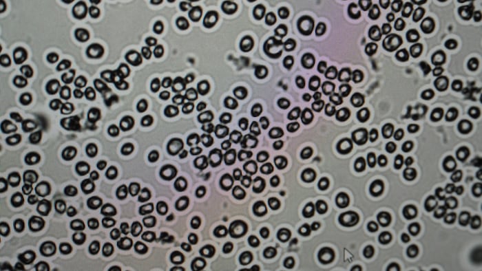 La microbiologie au service des microbrasseries | Radio-Canada
