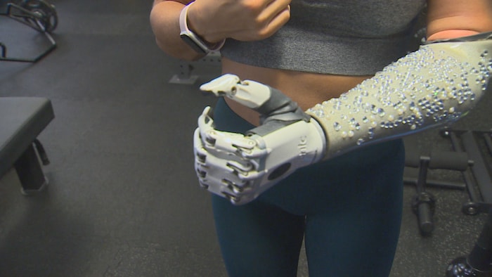 Avec sa main bionique, une Néo-Écossaise remporte des compétitions de ...