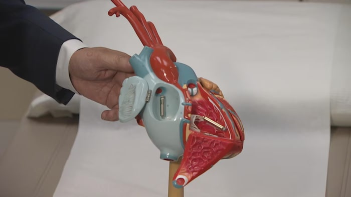 Calgary est l’une des 2 villes du pays à proposer un stimulateur ...