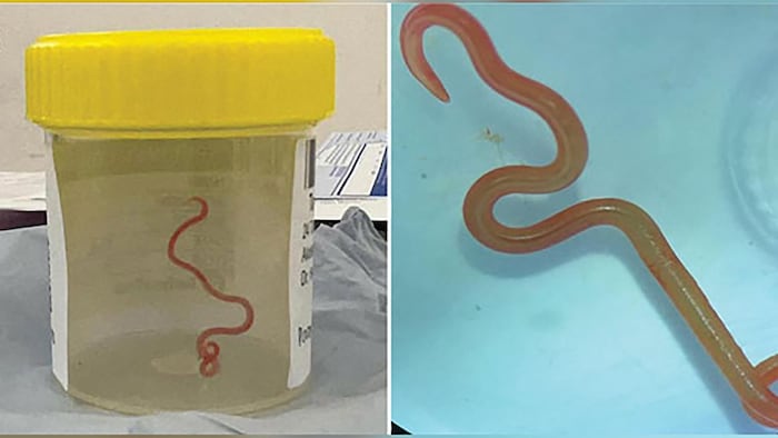Un ver qui parasite les serpents découvert dans le cerveau d’une ...