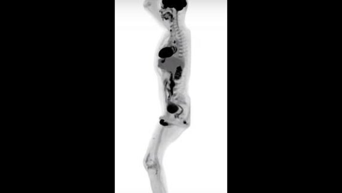 Des images du premier scanner corporel 3D dévoilées | Radio-Canada