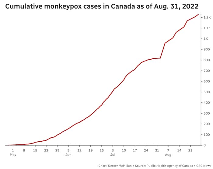 Monkeypox outbreak sa Canada nagpakita ng ‘downward trend,’ ayon sa ...