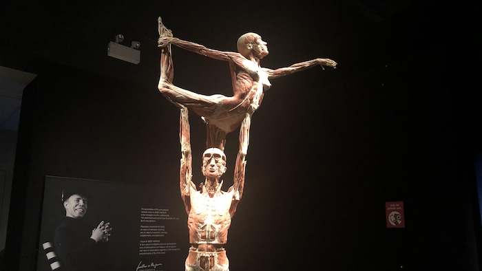 L’exposition Body Worlds revient à Halifax | Radio-Canada