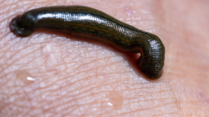 Mieux connaître les sangsues | OHdio | Radio-Canada