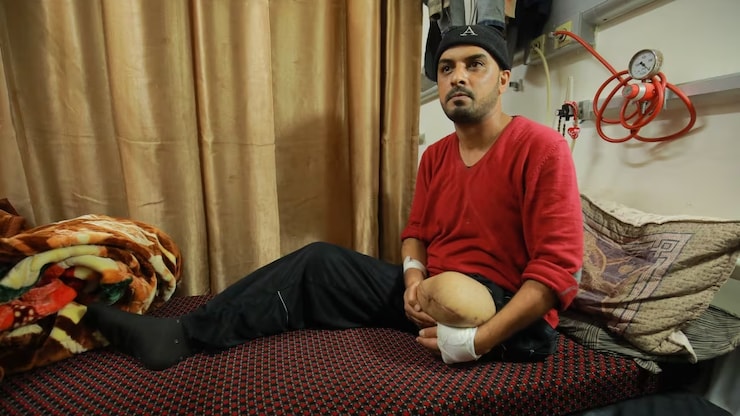 ’No one looks at me’: 12-year-old amputee in Gaza on what the war cost ...