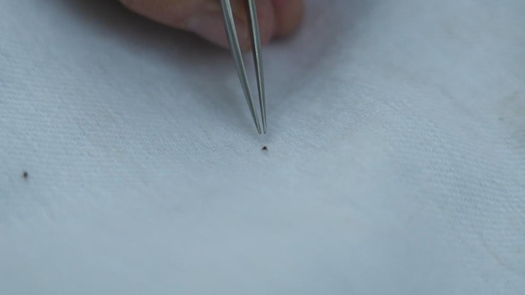 It’s time to ramp up efforts to prevent tick-borne illnesses ...