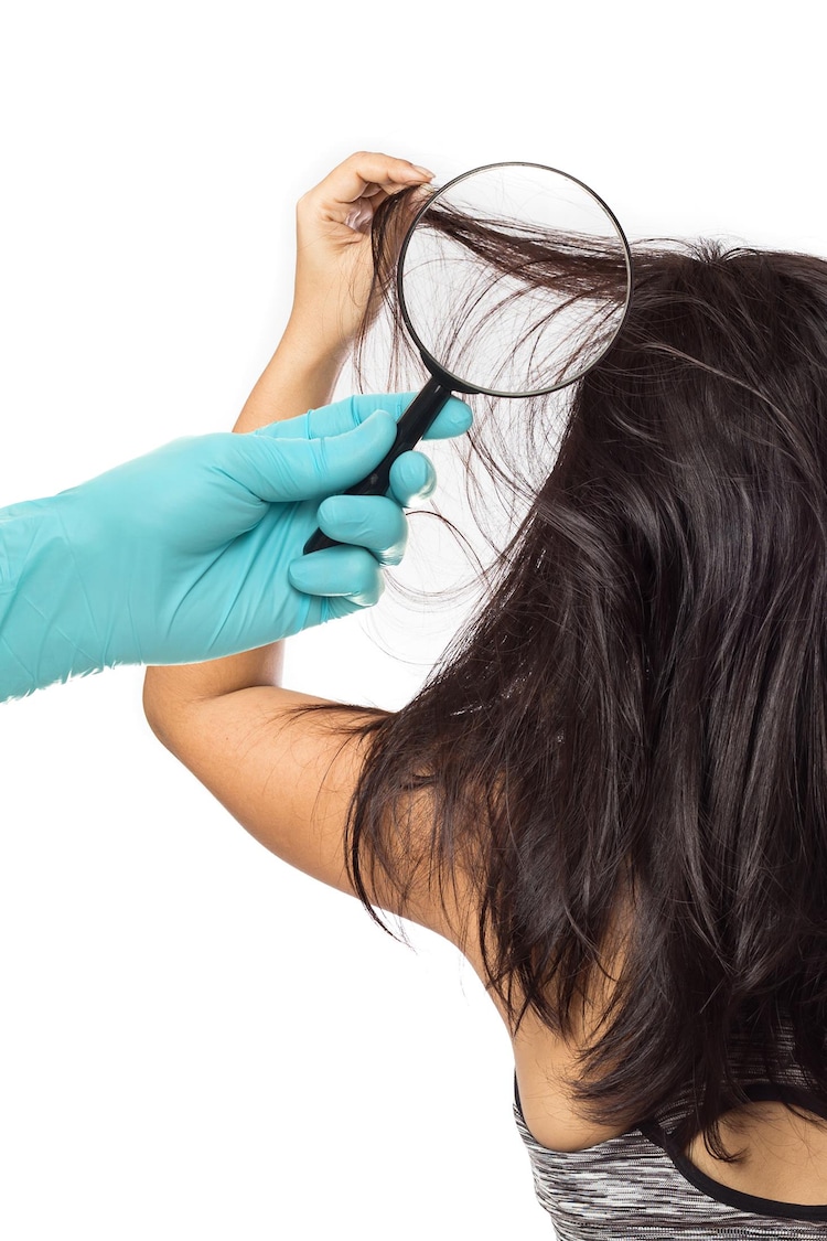 Intolérances alimentaires : des tests tirés par les cheveux | Radio-Canada