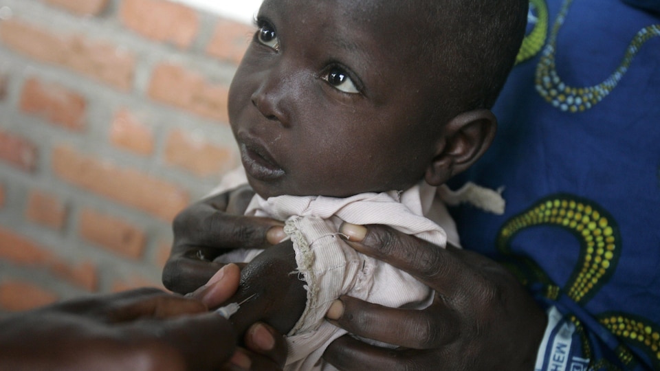 La rougeole a fait plus de 2700 morts en 7 mois en RDC | Radio-Canada.ca