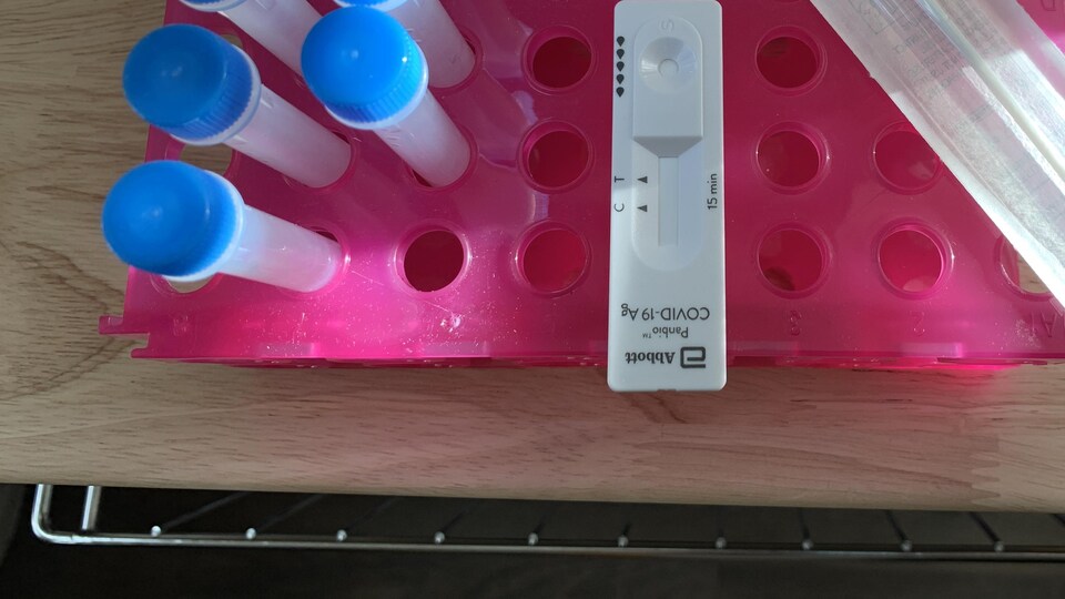 Forte demande pour les tests de dépistage dans les cliniques privées ...