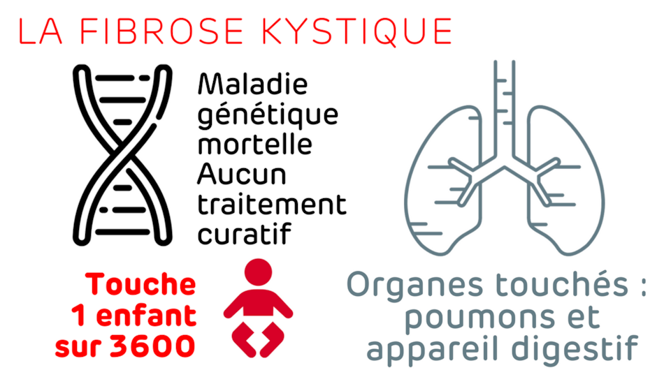 Québec instaure un test de dépistage de la fibrose kystique pour tous ...