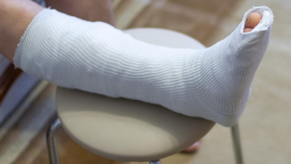 Santé avec le Dr Claude Beaulieu : les fractures chez les enfants