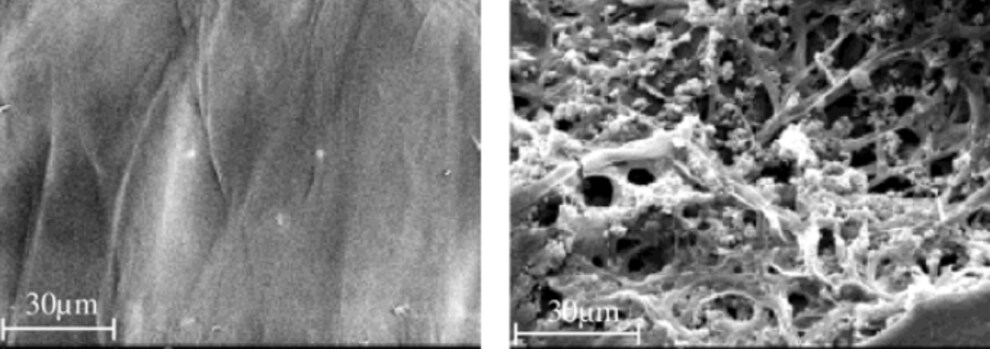 Des champignons capables de décomposer le plastique | MAJ | Radio-Canada