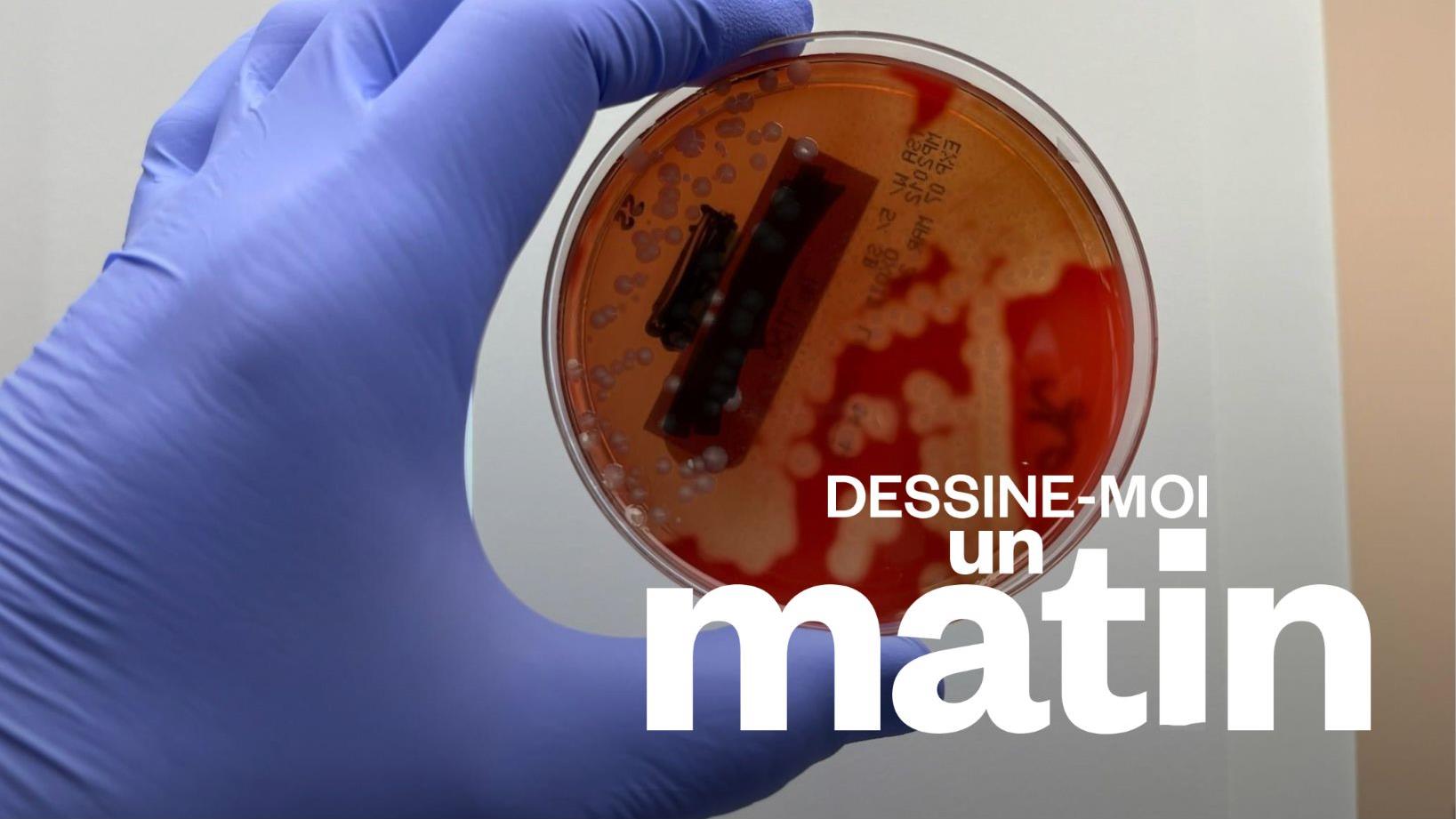 Reconnaître les symptômes du streptocoque A