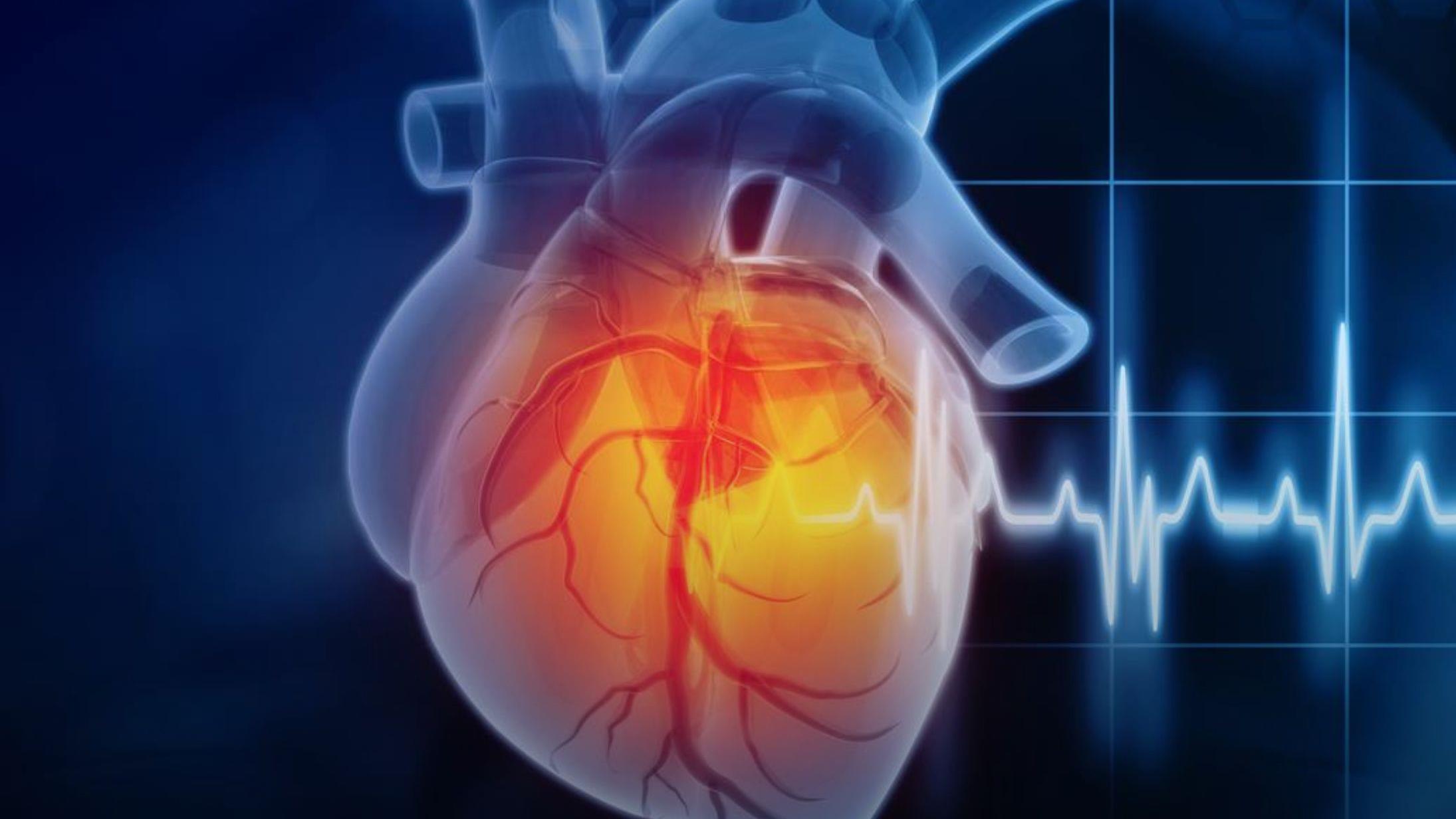 Arrêts cardiaques : la nécessité d'agir rapidement pour sauver des vies ...