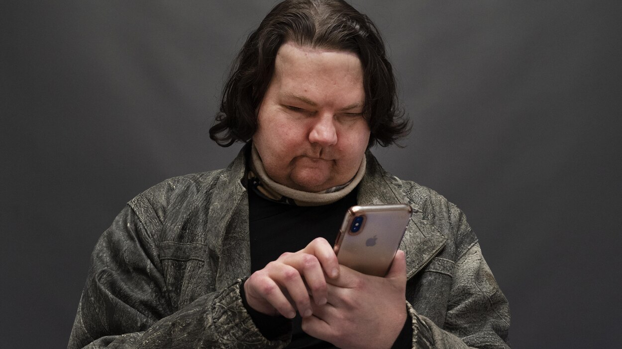 Triple greffe réussie du visage et des deux mains à New York | Radio-Canada