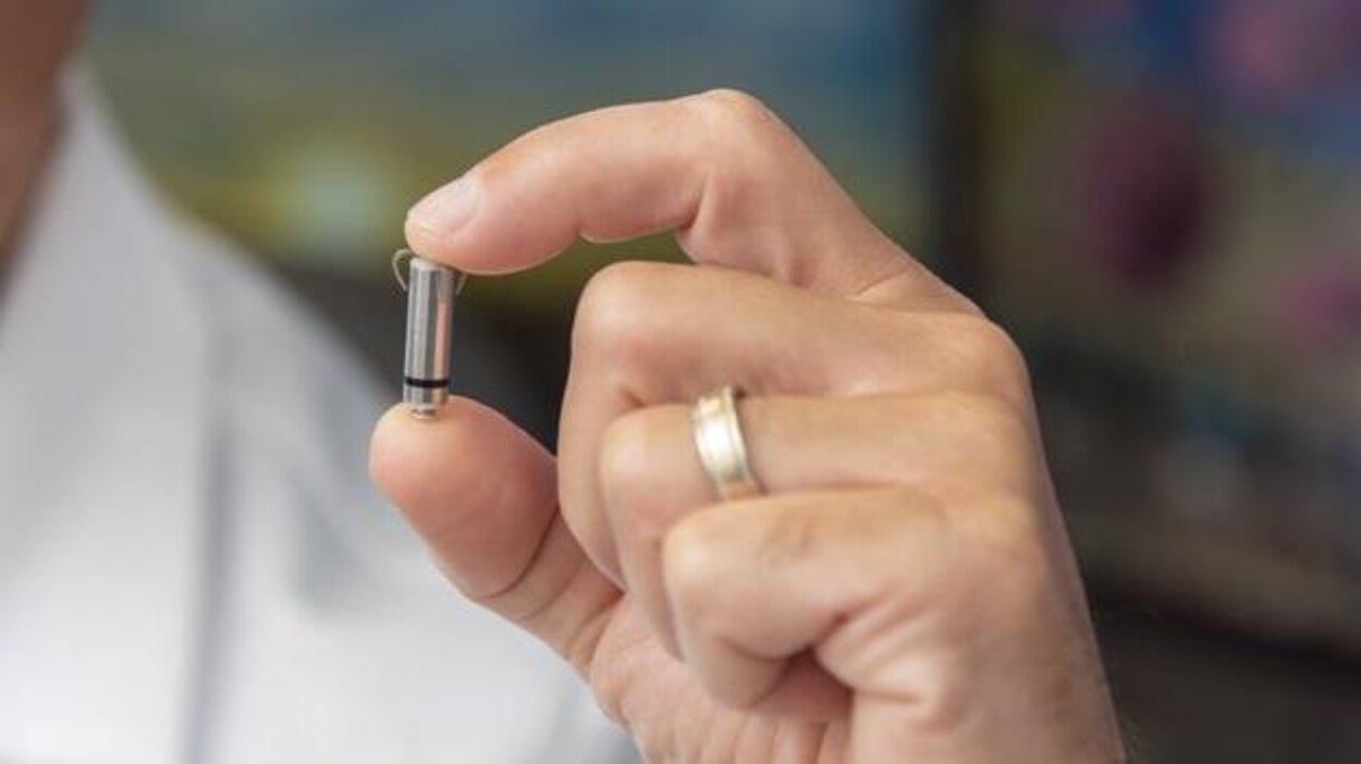 Un nouveau stimulateur cardiaque fait ses débuts au Canada | Radio-Canada