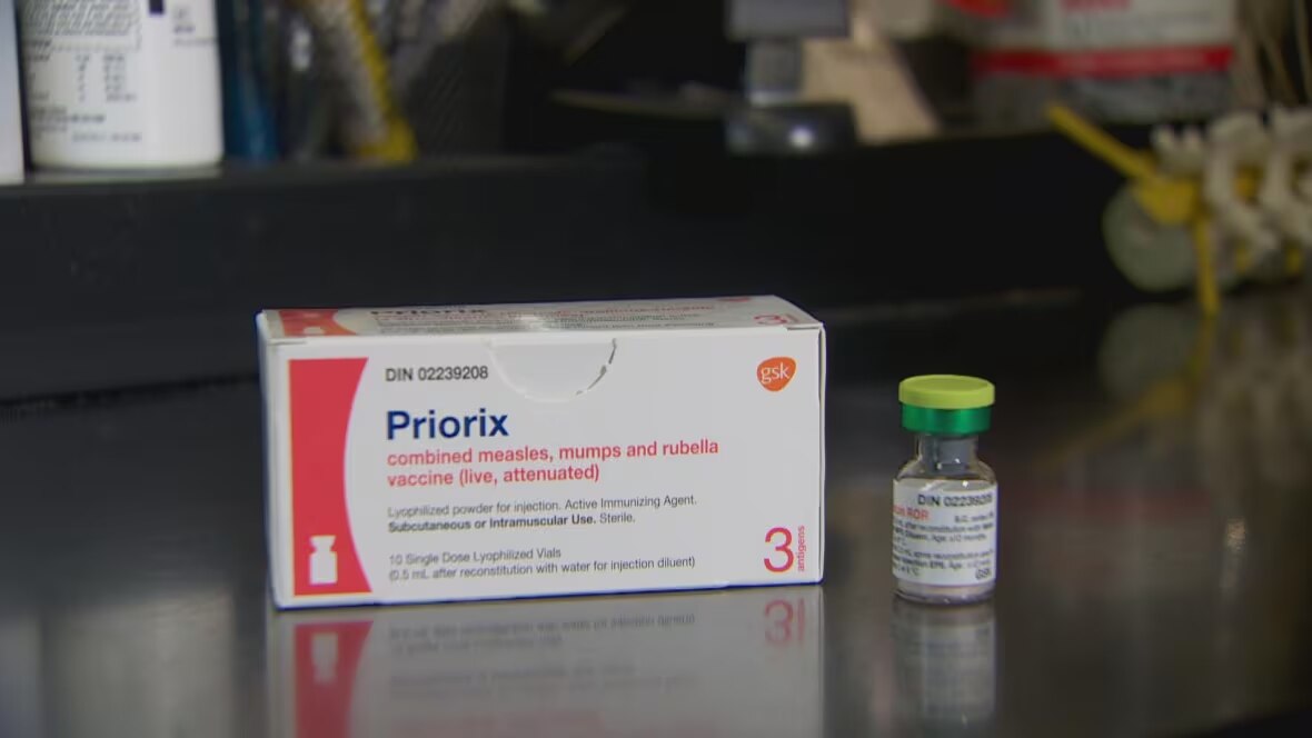 Comment se protéger de la rougeole, un virus très contagieux | OHdio ...