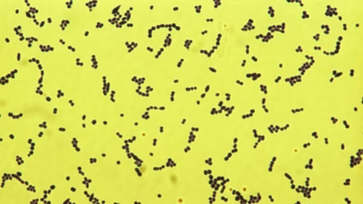 Spike in severe illness caused by strep A bacteria is ’global ...