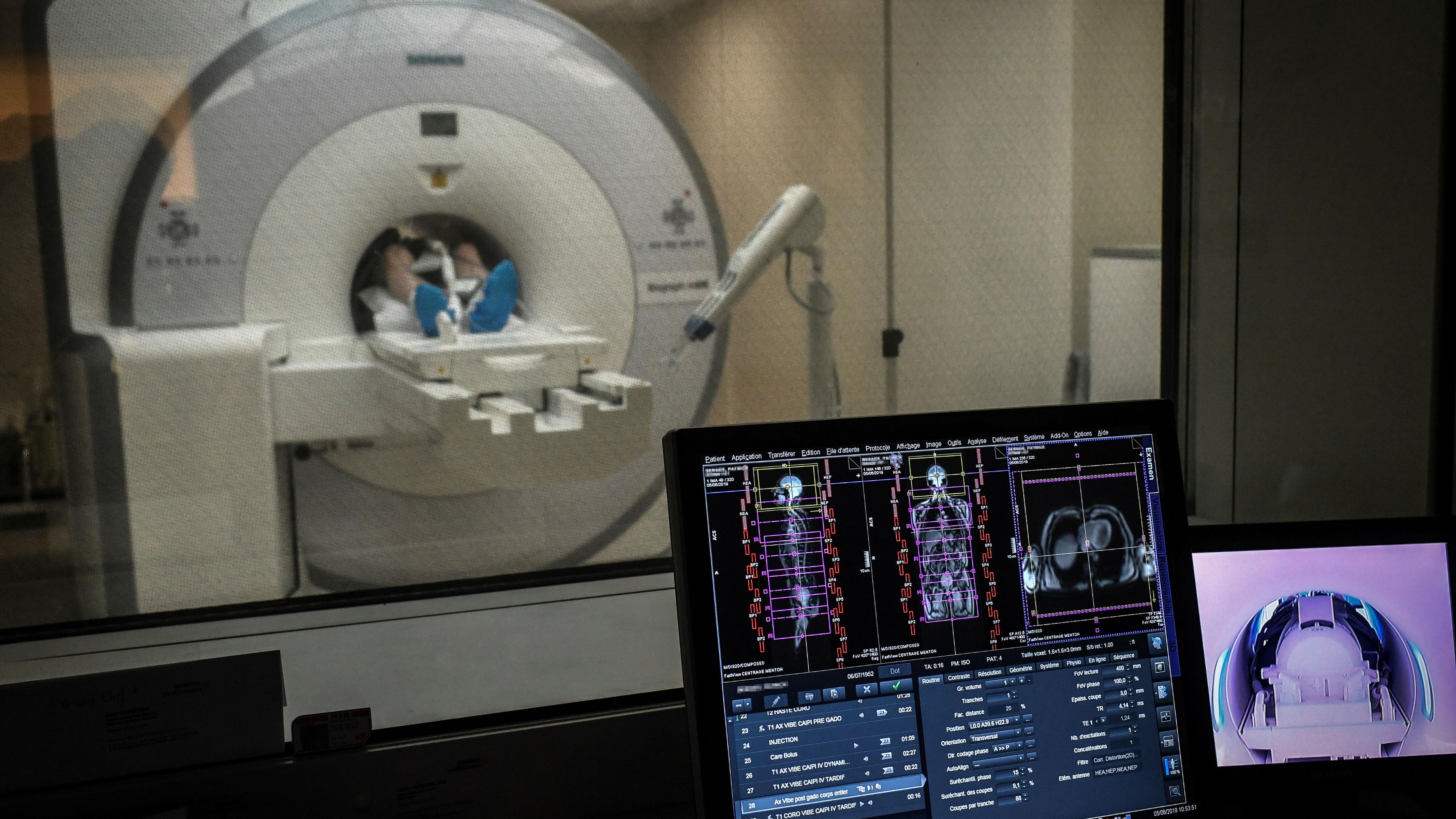 Le dépistage du cancer freiné par des files d’attente qui s’allongent ...