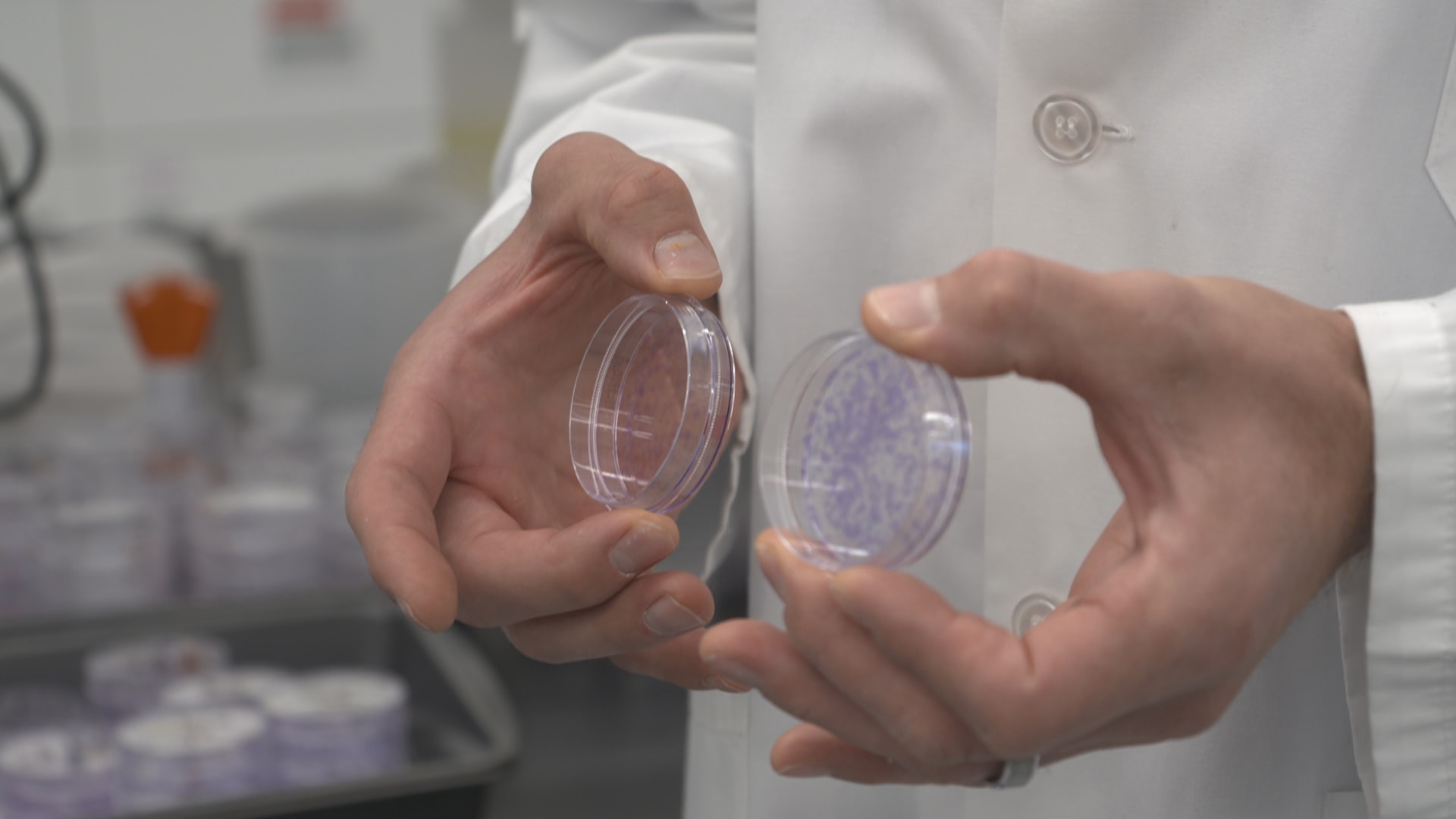 Radon : les ongles qui parlent | Le téléjournal Alberta