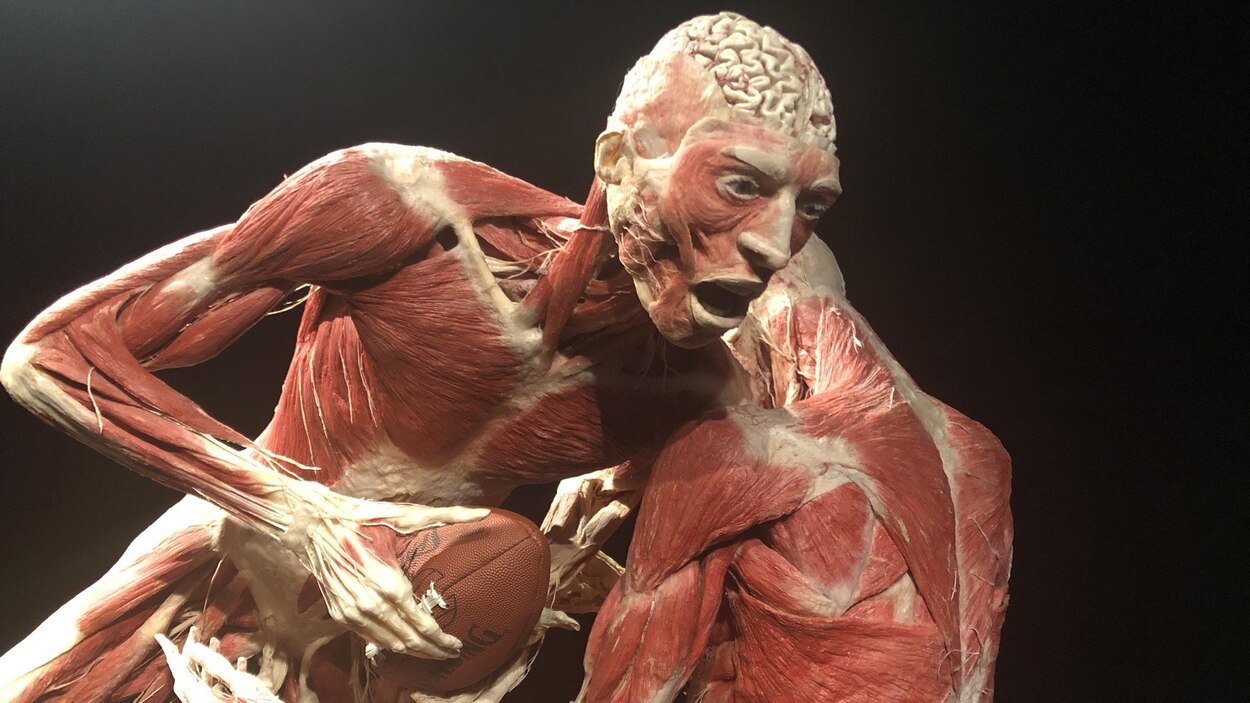 L’exposition Body Worlds revient à Halifax | Radio-Canada