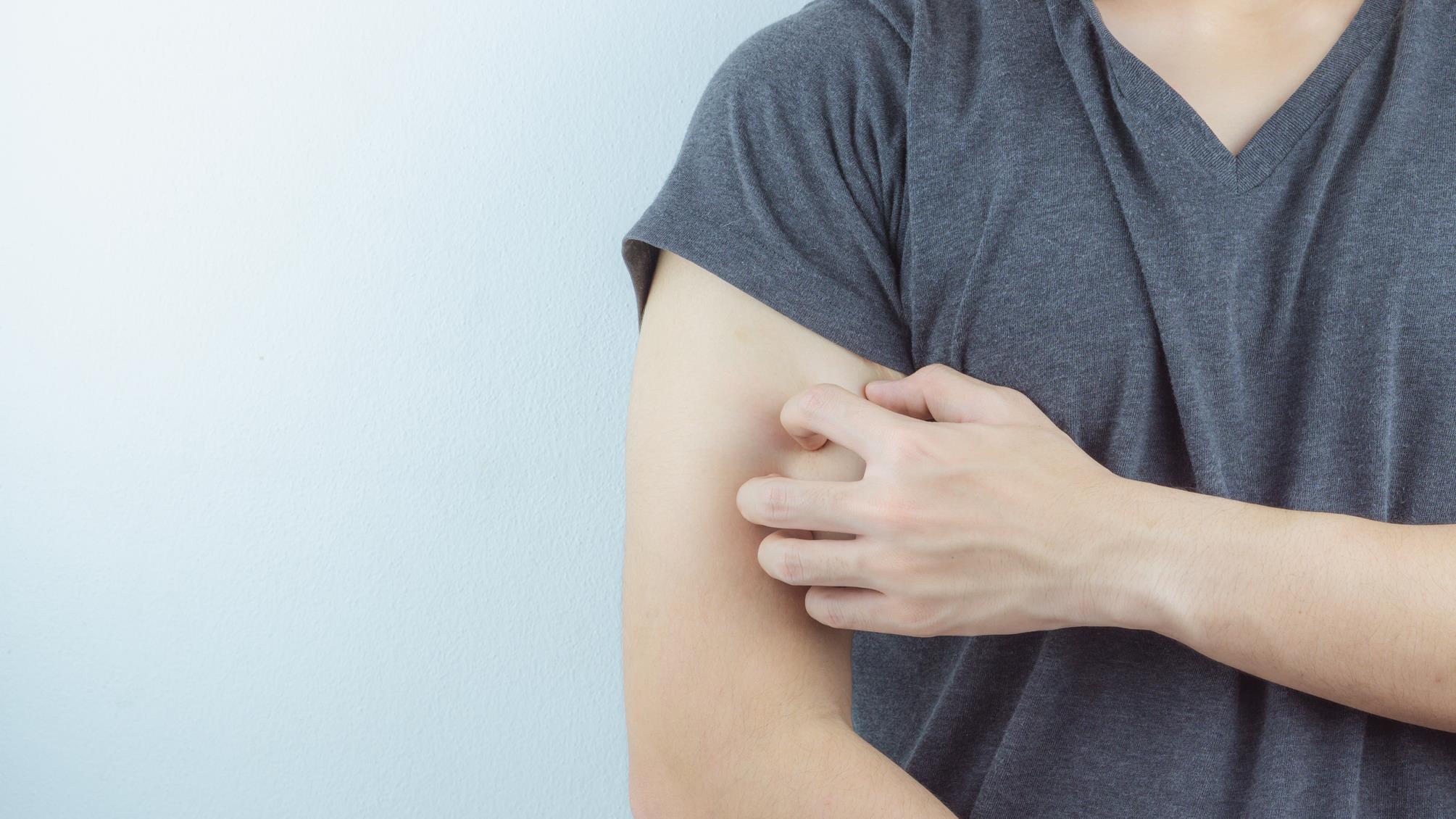 L'intérêt étonnamment récent de la science pour les démangeaisons de la ...