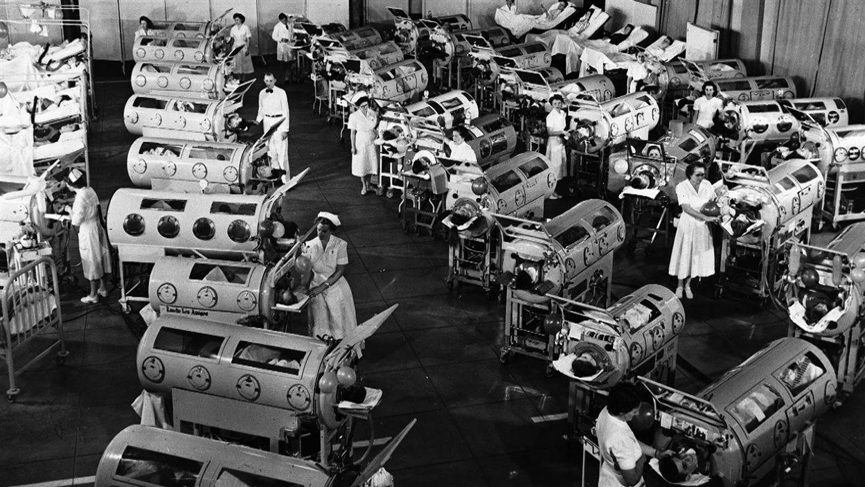 Les luttes contre les épidémies de polio au 20e siècle | OHdio | Radio ...