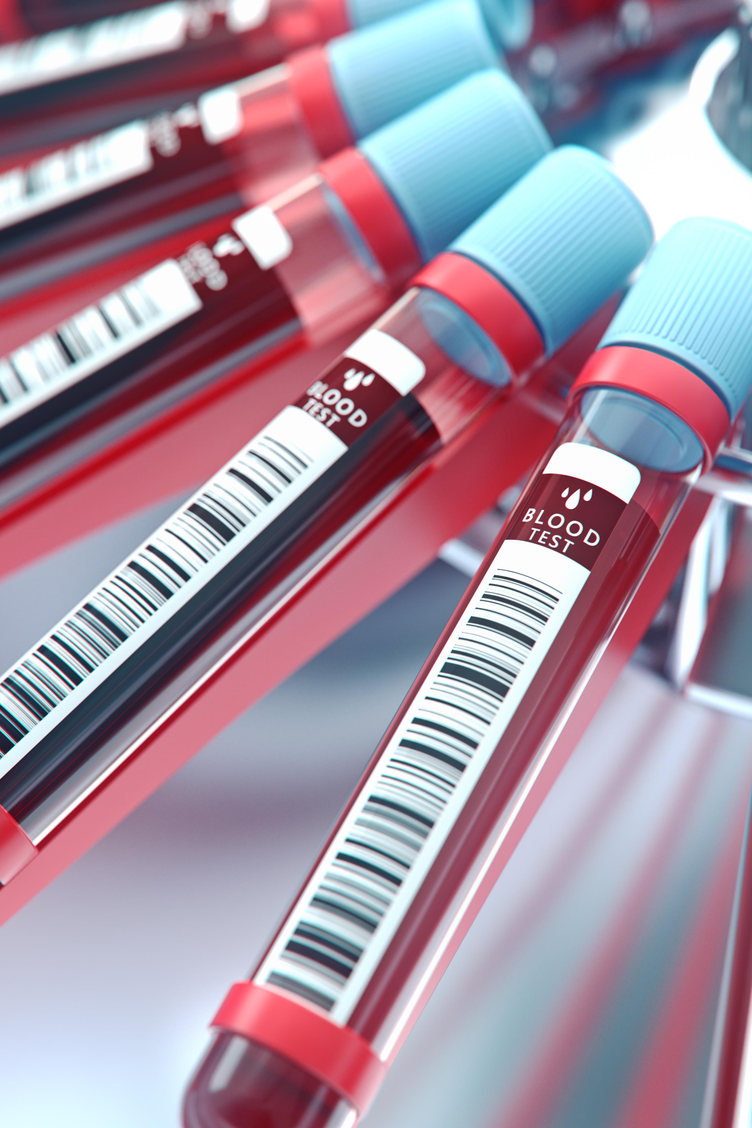 Collecte de sang à venir dans la région | OHdio | Radio-Canada