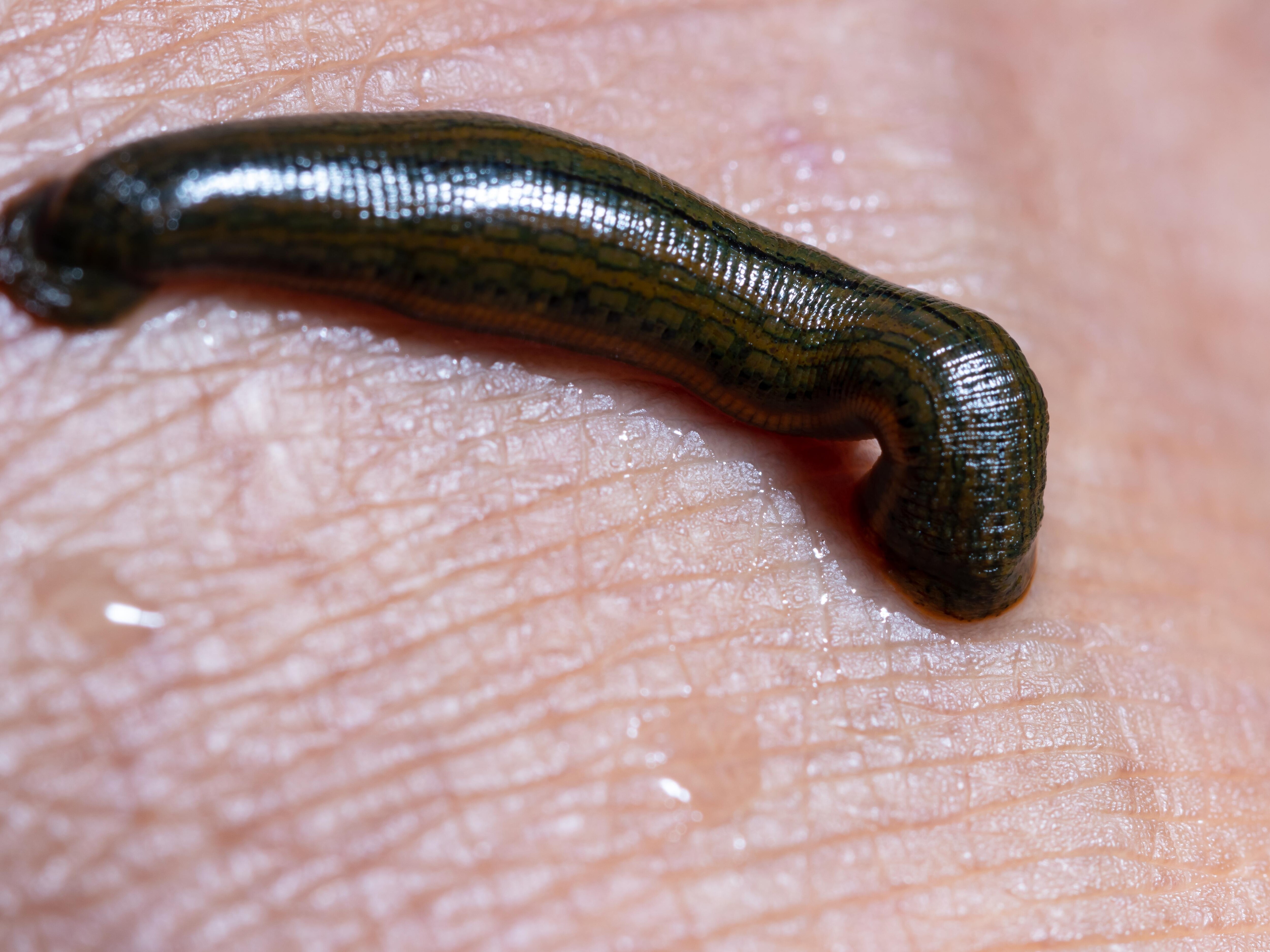 Mieux connaître la sangsue, cette éternelle incomprise | OHdio | Radio ...